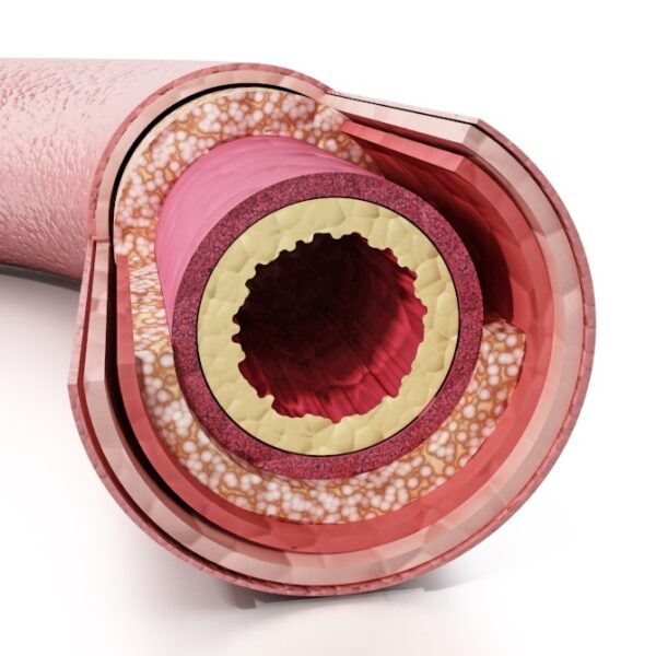 The 7 Core Strategies to Heal Leaky Gut and Fuel the Biome - Dr. Alex ...